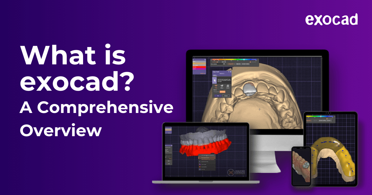 What is exocad? A Comprehensive Overview - Institute of Digital Dentistry