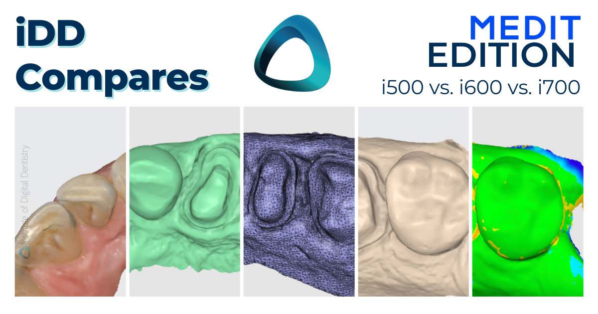 iDD Compares: A Medit Medley - i500 vs. i600 vs. i700 - Institute of ...