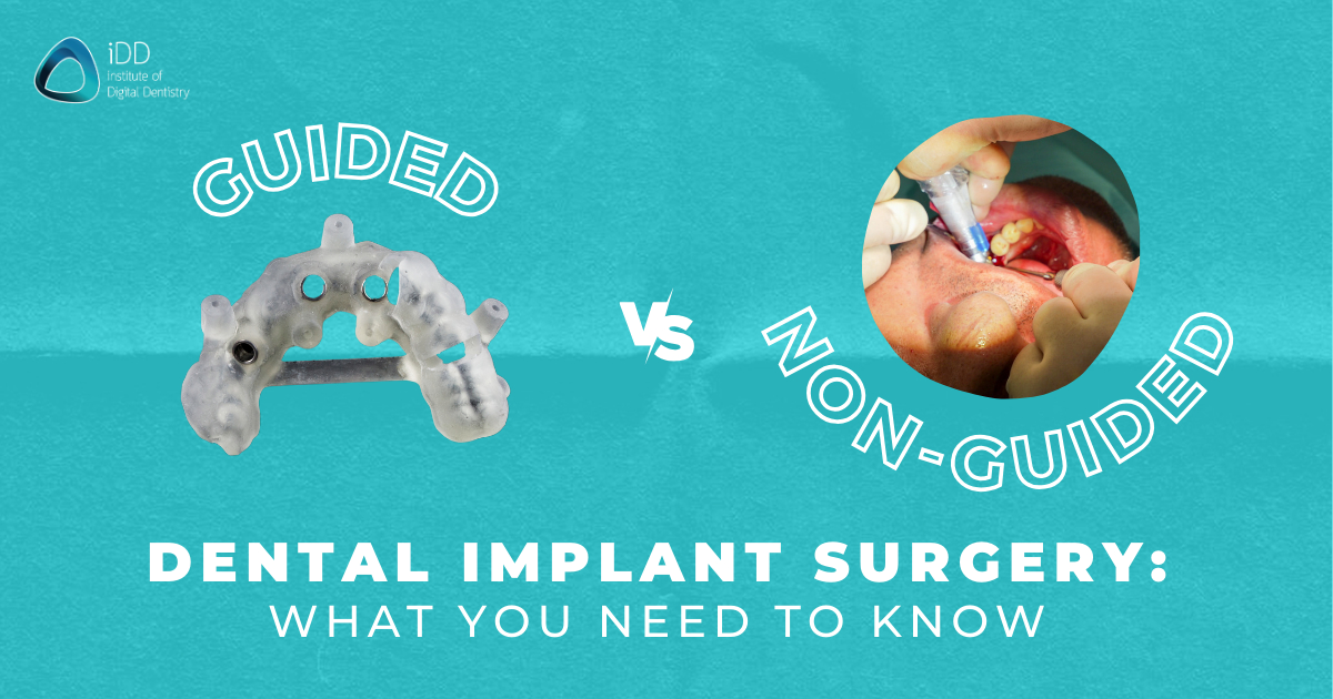 Guided vs. Non-Guided Dental Implant Surgery