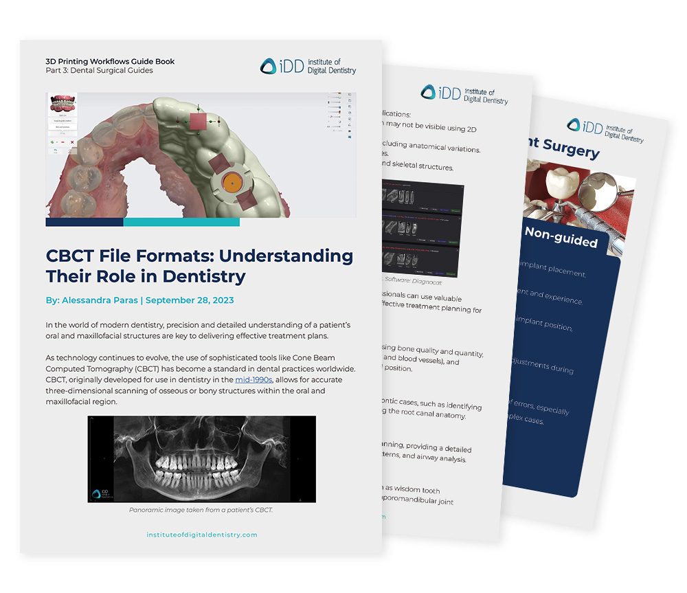 Dental Surgical Guides Workflow Free PDF Download