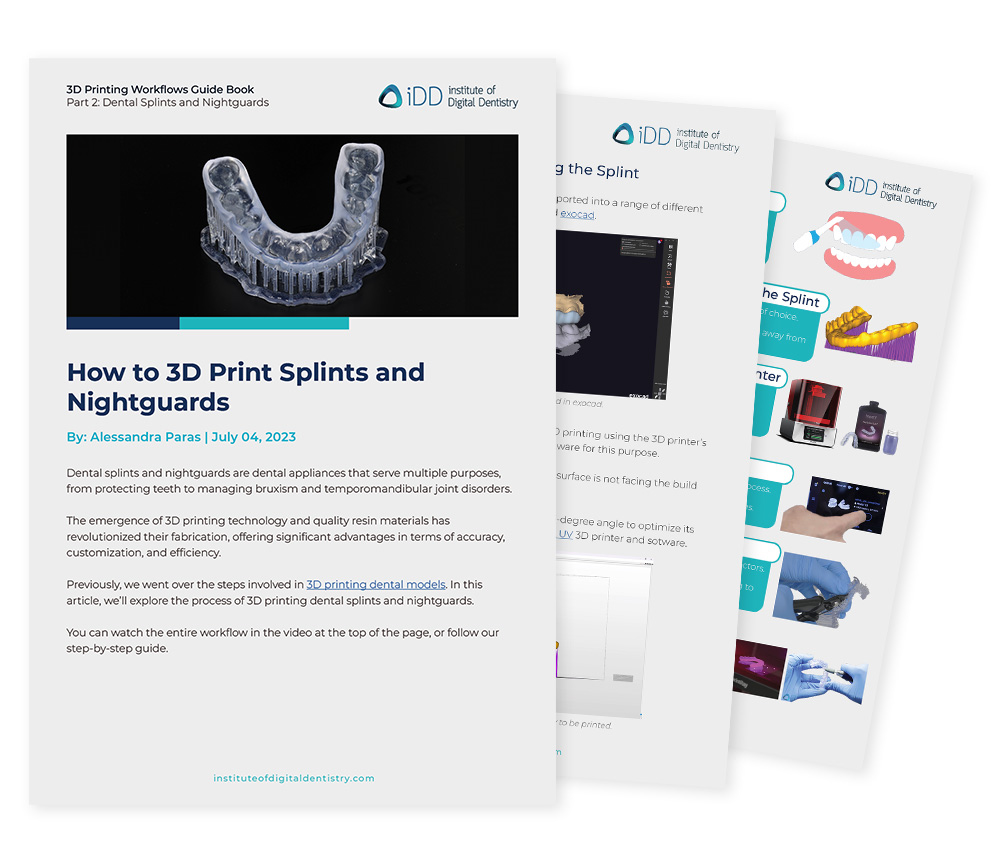 Dental Splints & Nightguards Workflow Free PDF Download