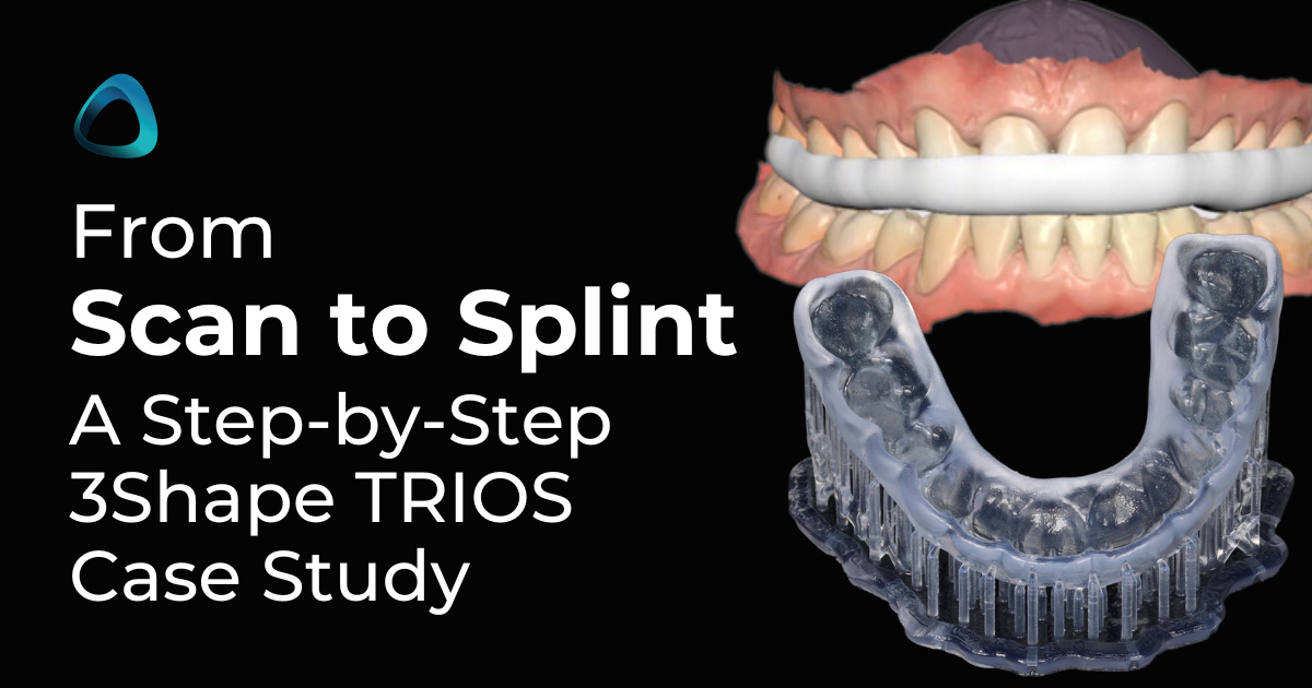 From Scan to Splint: A Step-by-Step 3Shape TRIOS Case Study - Institute of Digital Dentistry