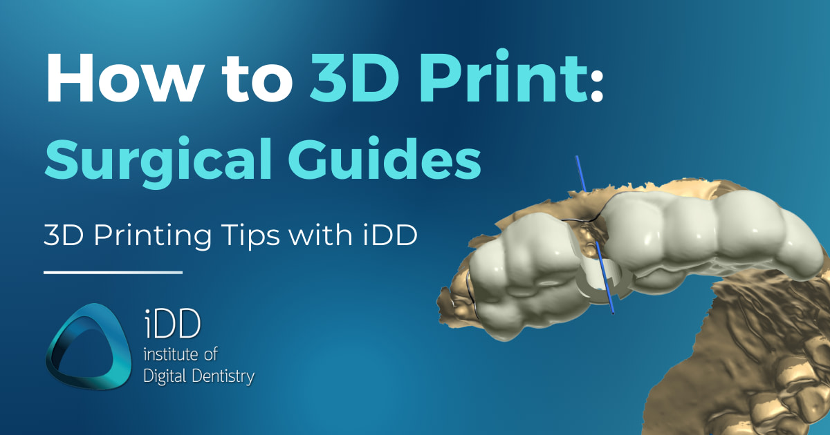 How to 3D Print Implant Surgical Guides for Stress-Free Implant Placement with iDD - Institute ...