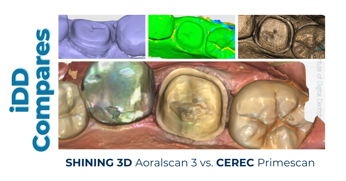 Shining 3D Aoralscan 3 vs. CEREC Primescan