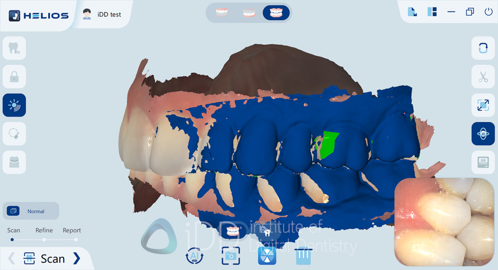 Helios 500 Intraoral Scanner Review