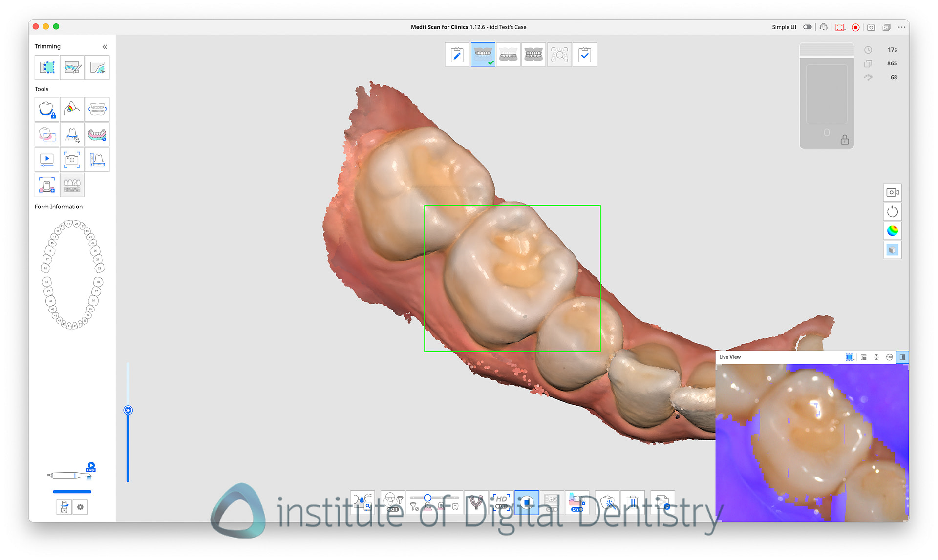 Medit i900 Intraoral Scanner Review | Institute of Digital Dentistry