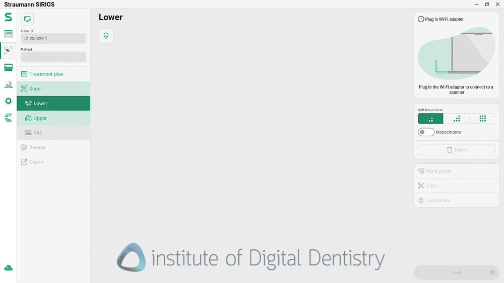 Straumann SIRIOS Intraoral Scanner Review by iDD