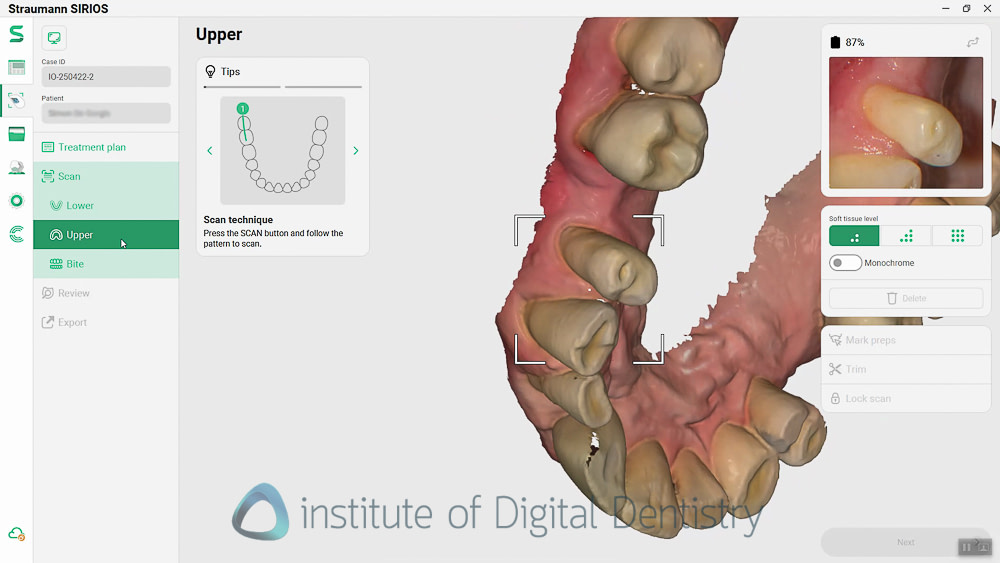Straumann SIRIOS Intraoral Scanner Review by iDD
