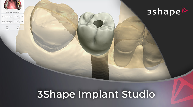 3Shape Online Courses | Institute of Digital Dentistry