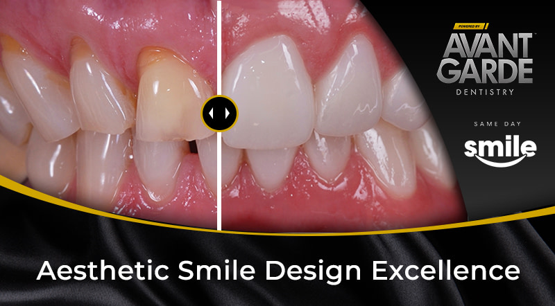 Digital Dental Courses | Institute of Digital Dentistry