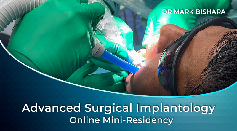 Advanced Surgical Implantology Mini-Residency Online Course | iDD