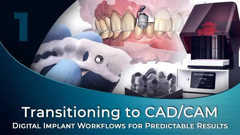 Digital Implant Workflows for Predictable Results Digital Implant Workflows for Predictable Results