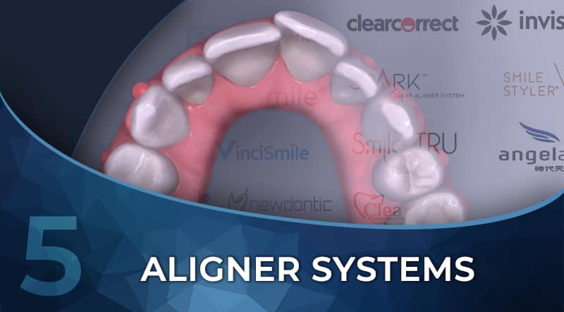 How to Choose an Aligner System