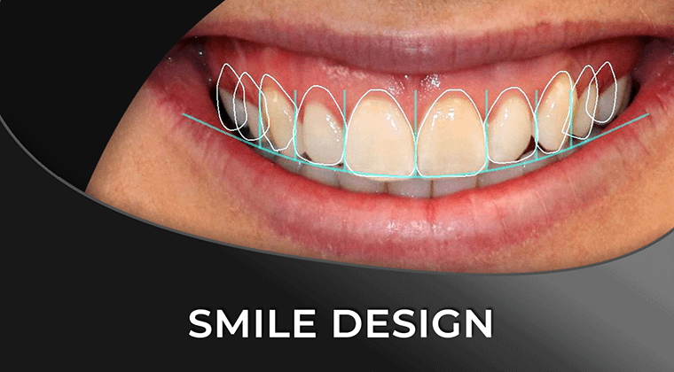 Smile Design Guide - Comprehensive Online Training